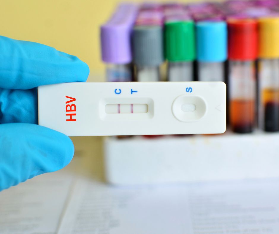 Réseau SAM - Hépatite B