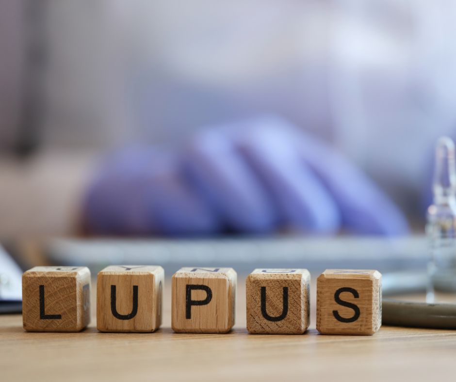Réseau SAM - Lupus érythémateux disséminé (LED) ou lupus systémique (LS)