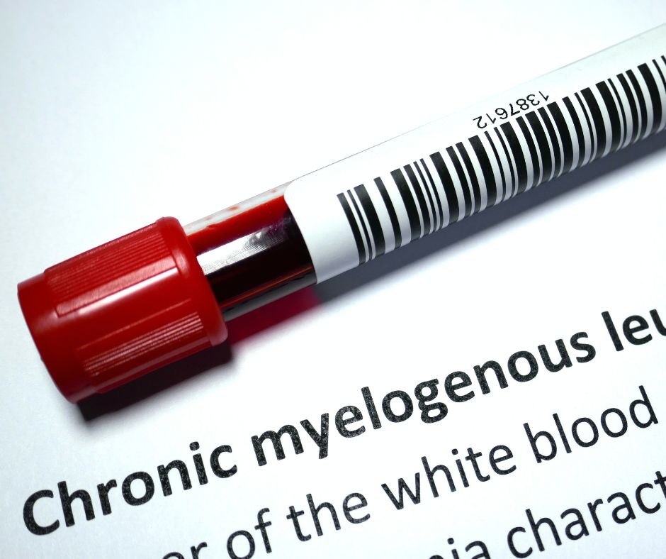 Réseau SAM - Leucémie myéloïde chronique